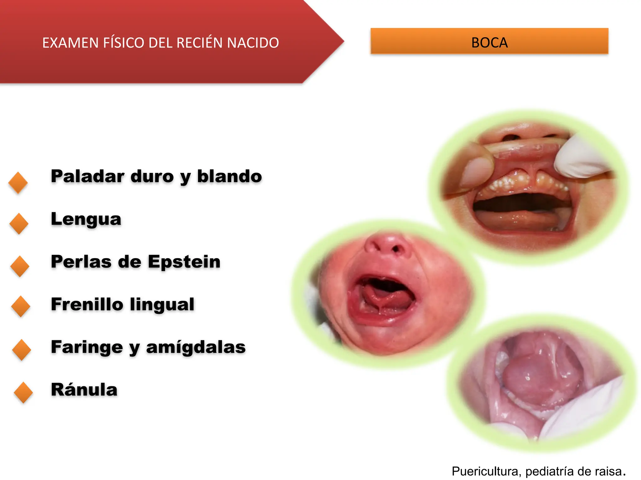 540463925-examen-fisico-del-recien-nacido.pptx 540463925-examen-fisico-del-recien-nacido.pptx
