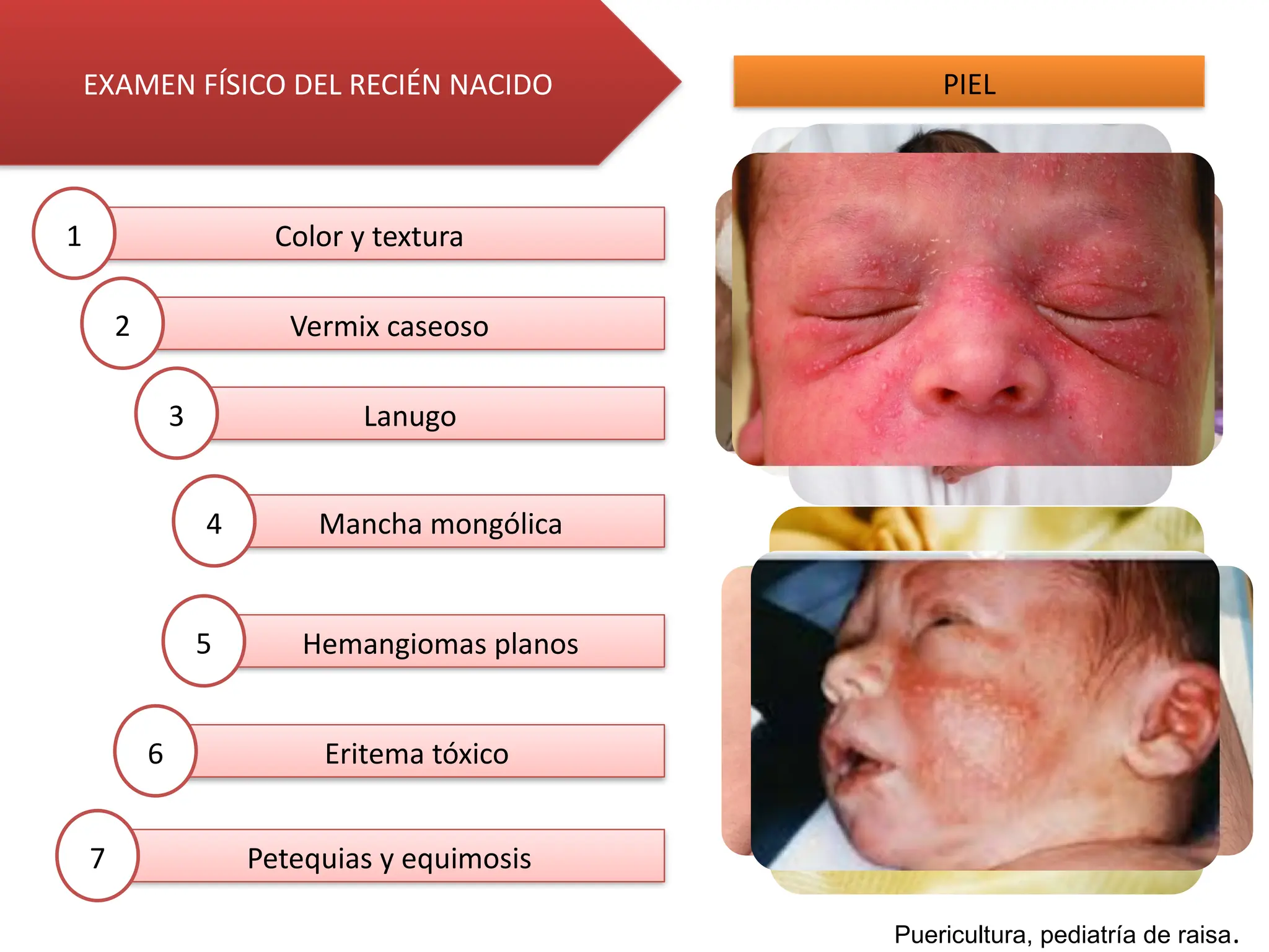 540463925-examen-fisico-del-recien-nacido.pptx 540463925-examen-fisico-del-recien-nacido.pptx