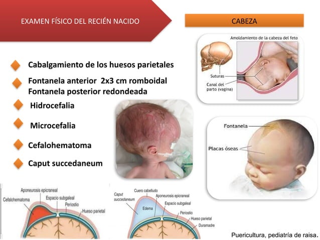 540463925-examen-fisico-del-recien-nacido.pptx 540463925-examen-fisico-del-recien-nacido.pptx
