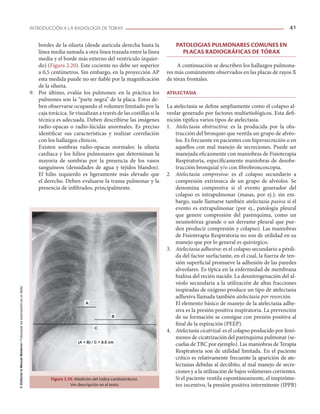 FUNDAMENTOS DE FISIOTERAPIA RESPIRATORIA Y VENTILACIÓN MECÁNICA | PDF