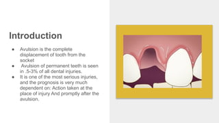 Avulsion.pdf | Dental Health | Diseases and Conditions