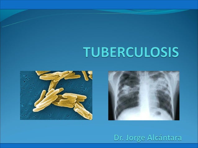 Prevención y control de las tuberculosis - CICAT-SALUD | PPT ...
