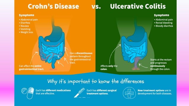 Nutrition in Ulcerative Colitis | PPTX | Digestive Disorders | Diseases ...