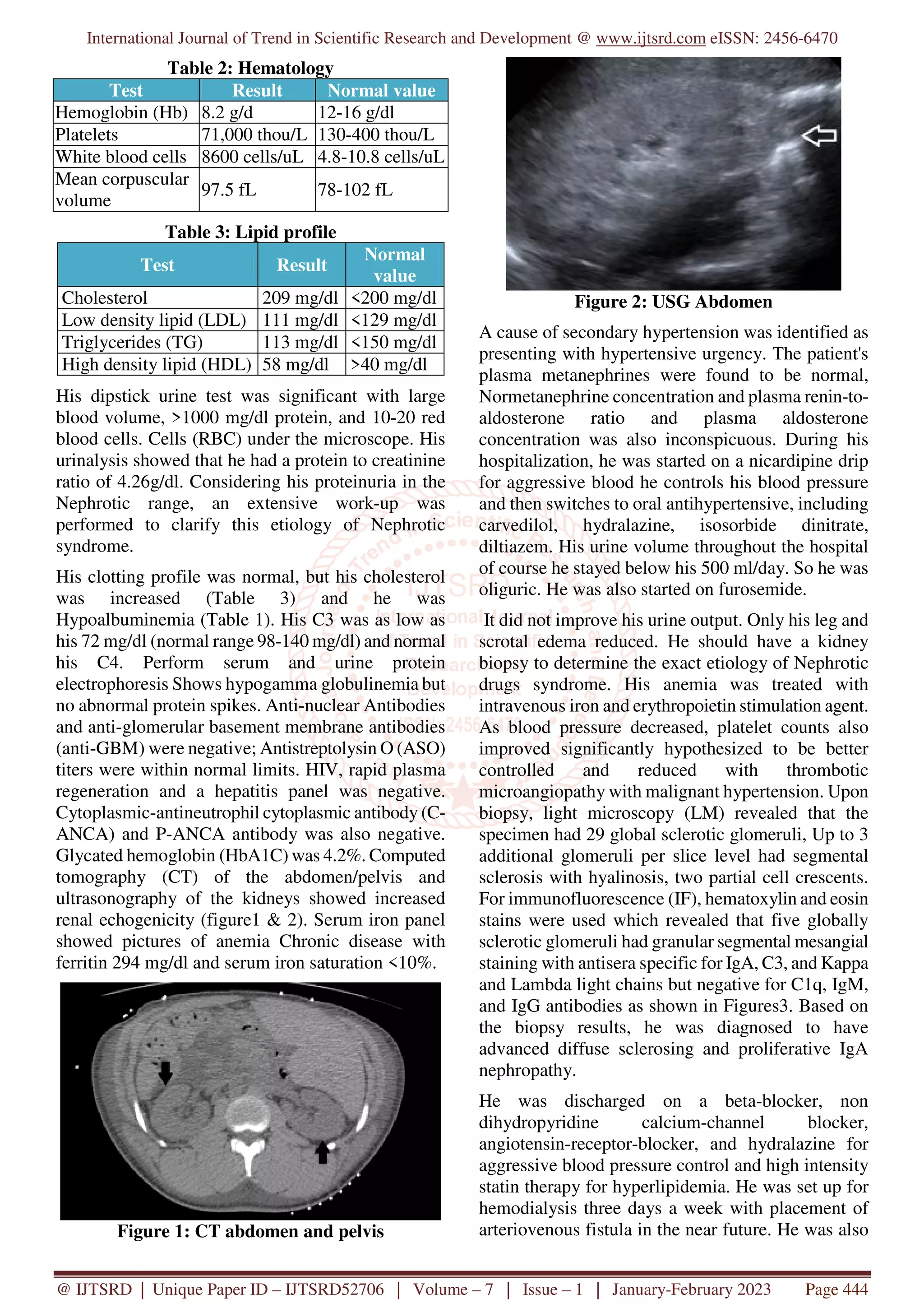IgA Nephropathy Burgers Disease Case Report | PDF