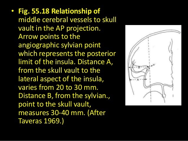 55 DAVID SUTTON PICTURES VASCULAR IMAGING IN NEURORADIOLOGY