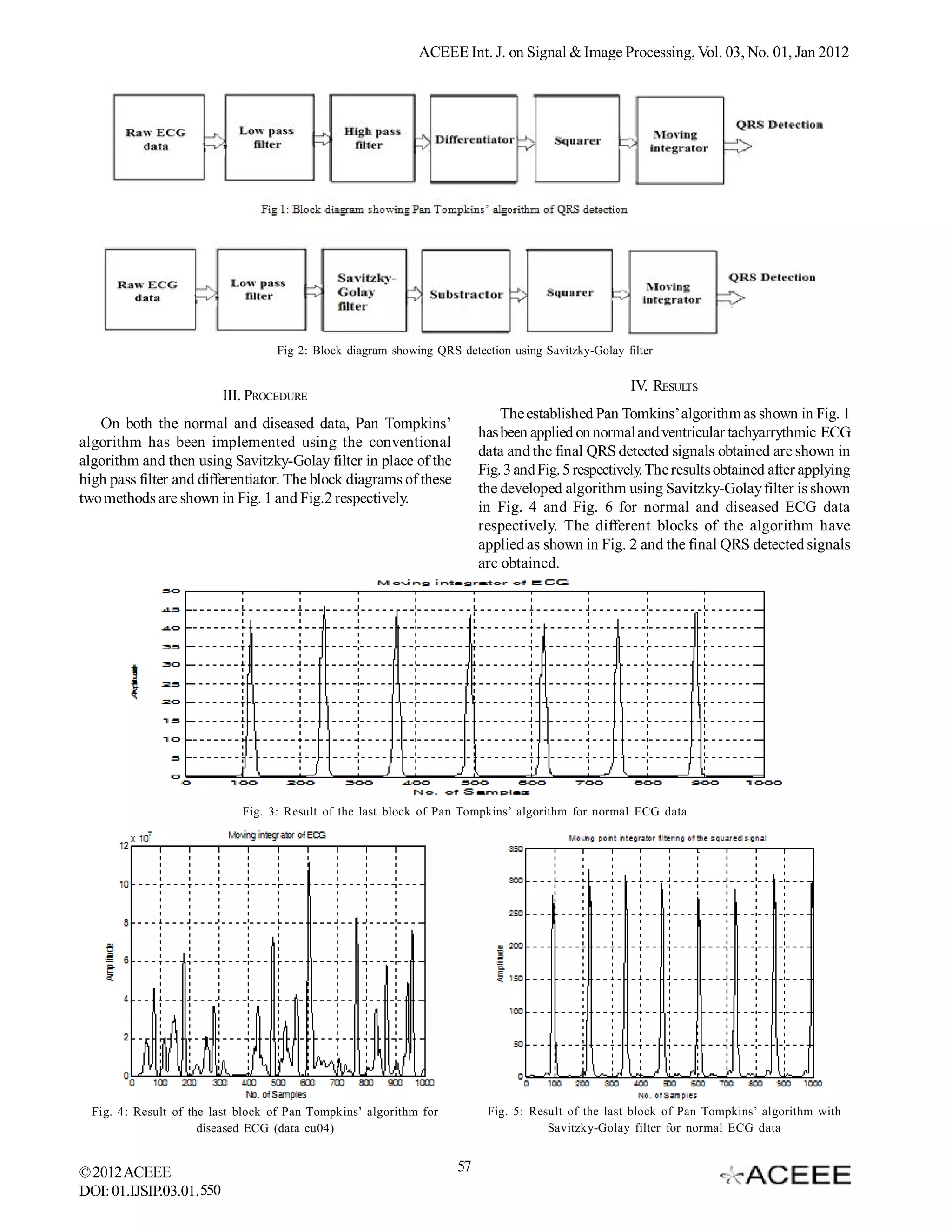 Qrs Detection Algorithm Using Savitzky Golay Filter Pdf Heart And