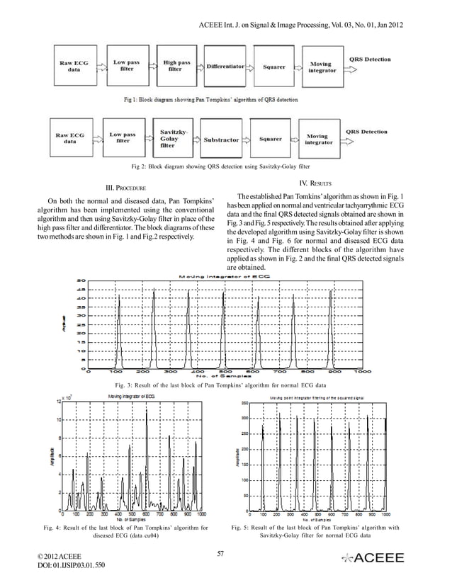 Qrs Detection Algorithm Using Savitzky Golay Filter Pdf 7930