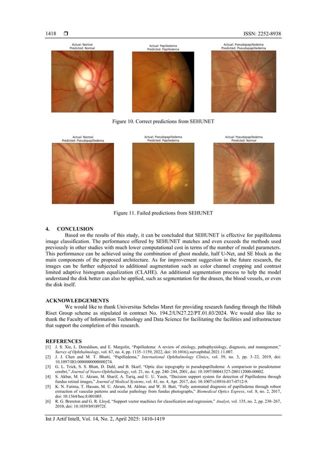 Squeeze-excitation half U-Net and synthetic minority oversampling ...