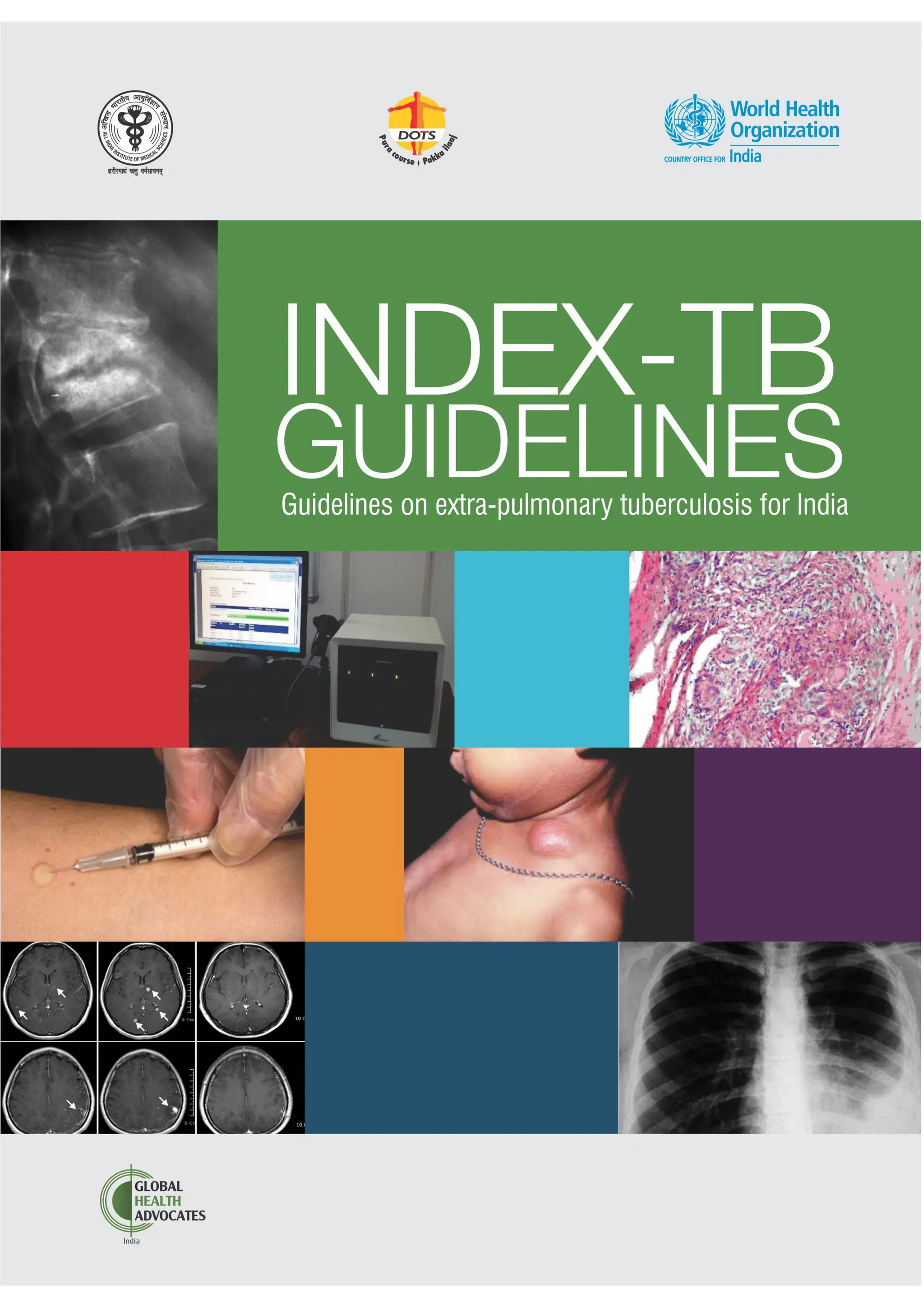 Index TB Guidelines- government of iNdia | PDF