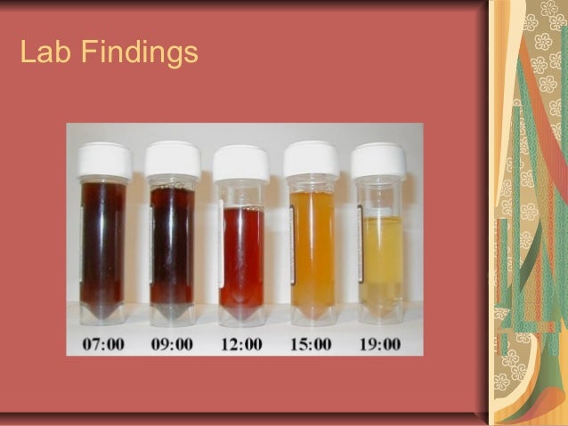 Paroxysmal Nocturnal Hemoglobinuria