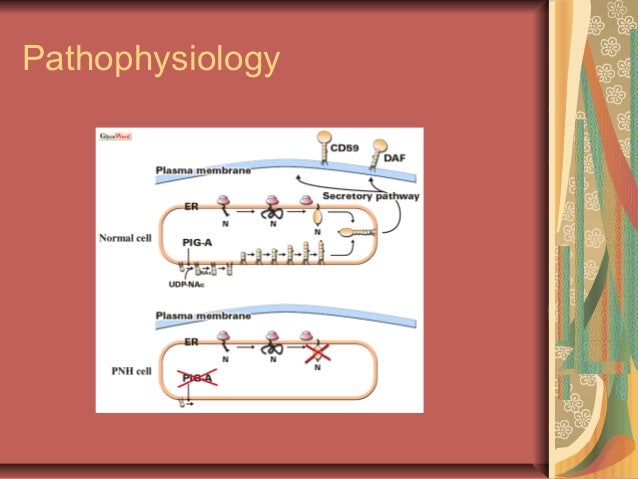 Paroxysmal nocturnal hemoglobinuria path slide - qerycycle