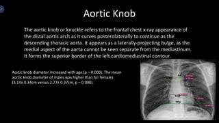 55 Kr Shashikant Raj (CVS X-ray) (1).pptx
