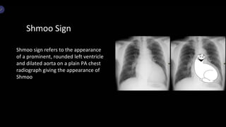55 Kr Shashikant Raj (CVS X-ray) (1).pptx