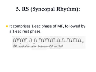 560581095-2-Diadynamic-Current (1).pptx