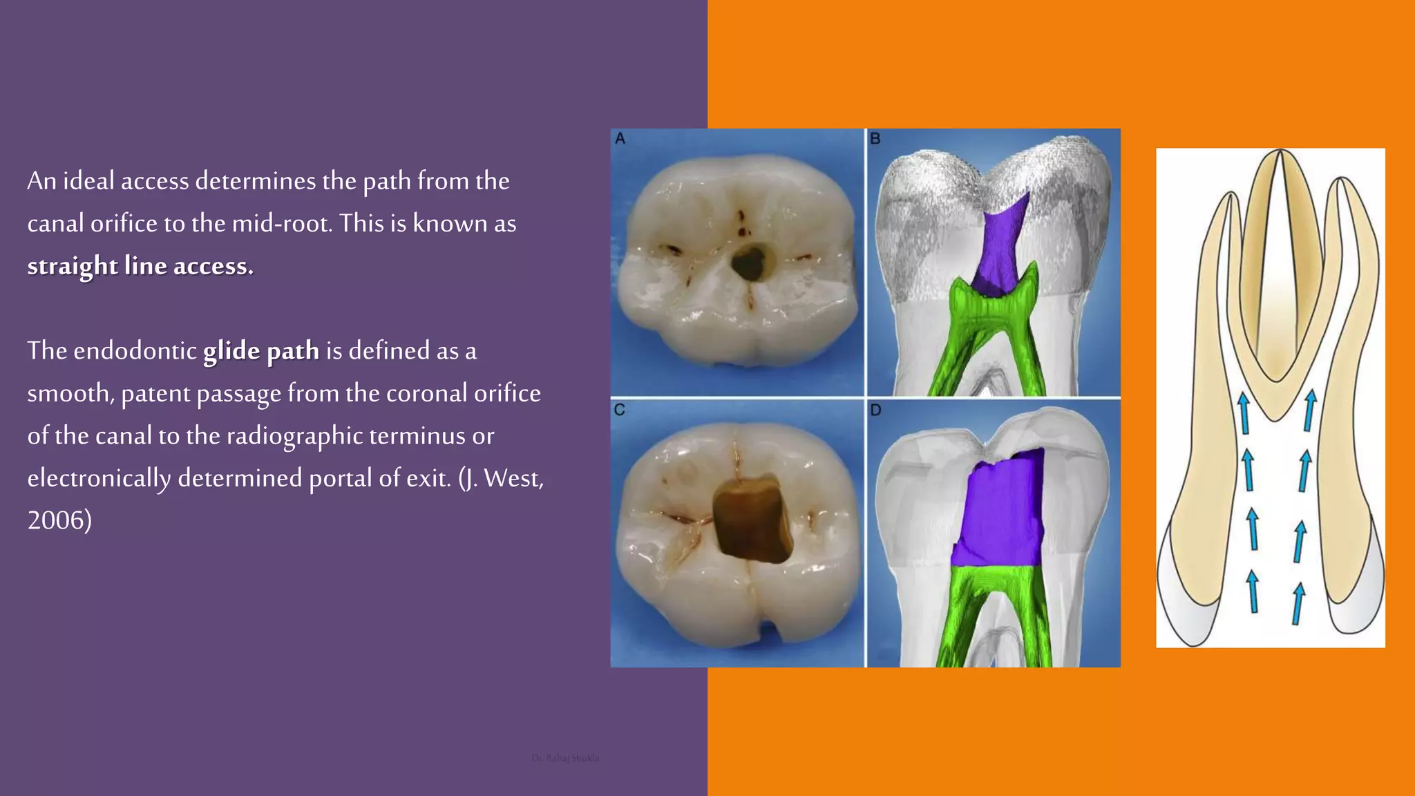 Pulpectomy in Pediatric Dentistry | PPTX