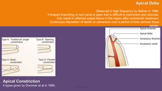 Pulpectomy in Pediatric Dentistry | PPTX