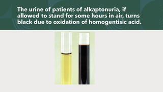 ALKAPTONURIA | PDF