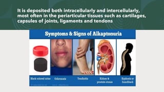 ALKAPTONURIA | PDF