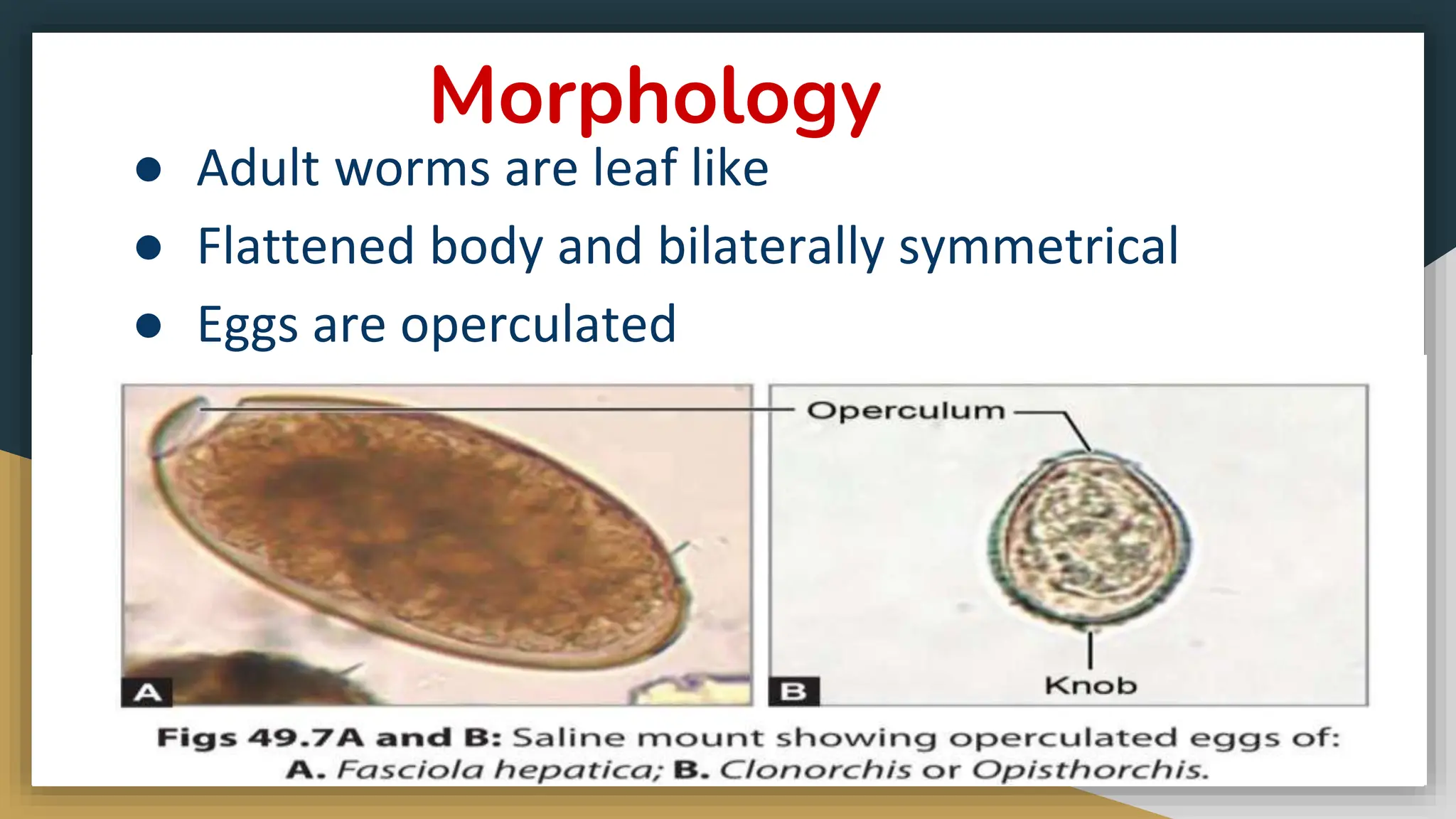 Trematode infections of Hepatobiliary system.pptx