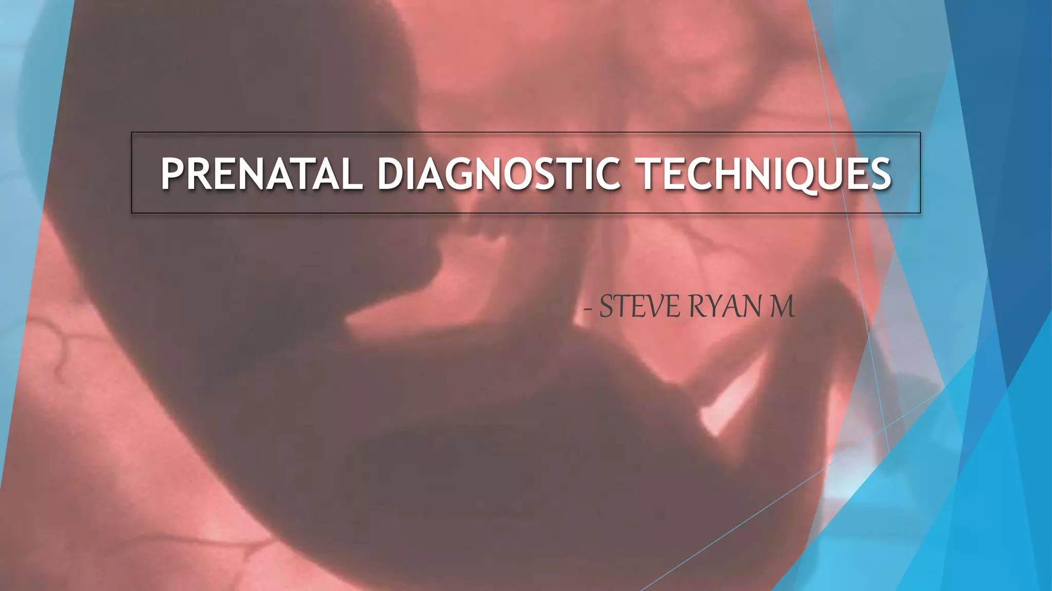Prenatal Diagnosis Techniques Ppt
