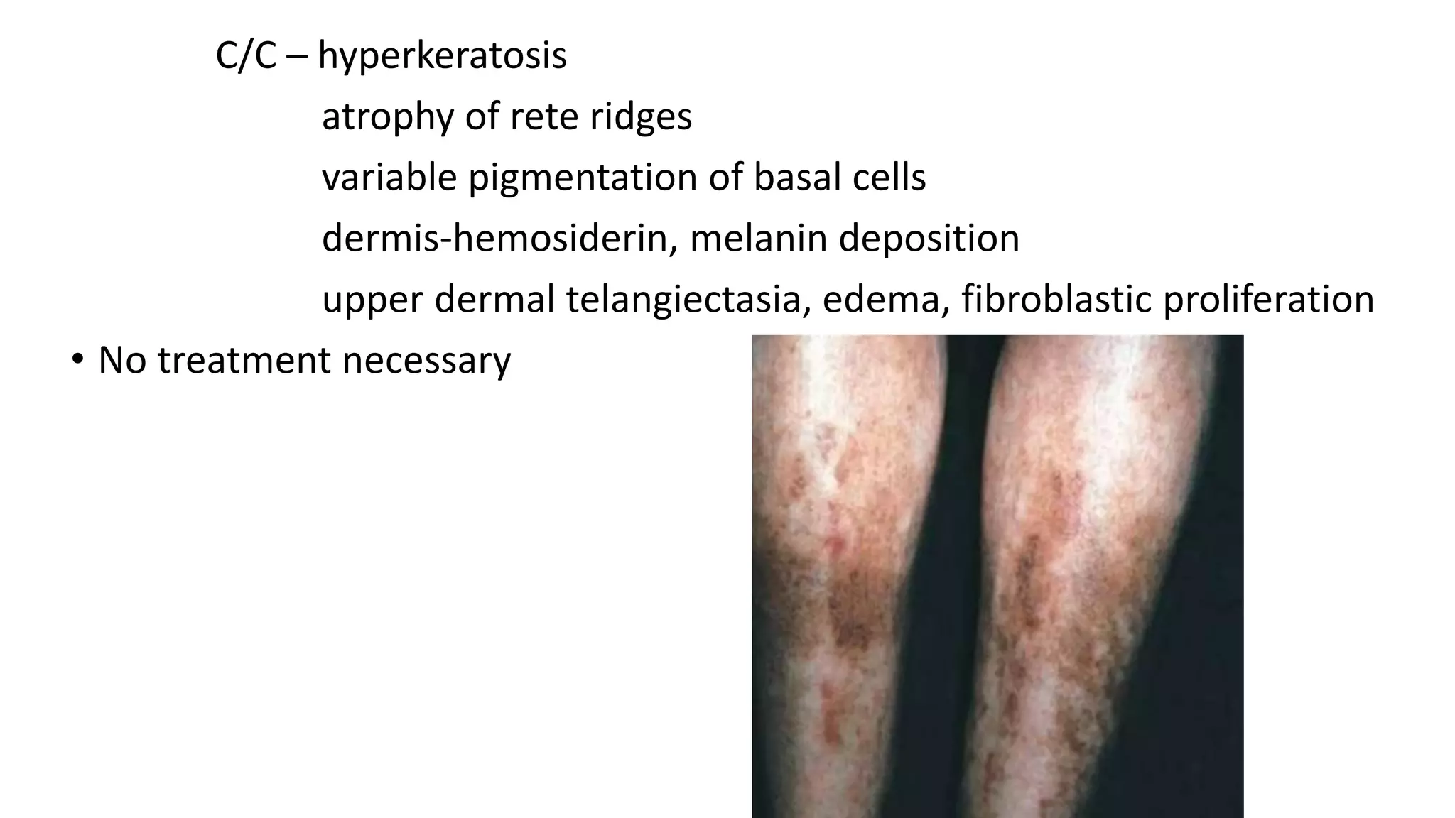 CUTANEOUS MANIFESTATIONS OF DM.pptx