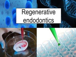 REGENERATIVE ENDODONTICS | PPT