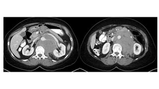 5_6134079791160100714.pptx