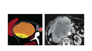 5_6134079791160100714.pptx