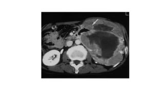 5_6134079791160100714.pptx