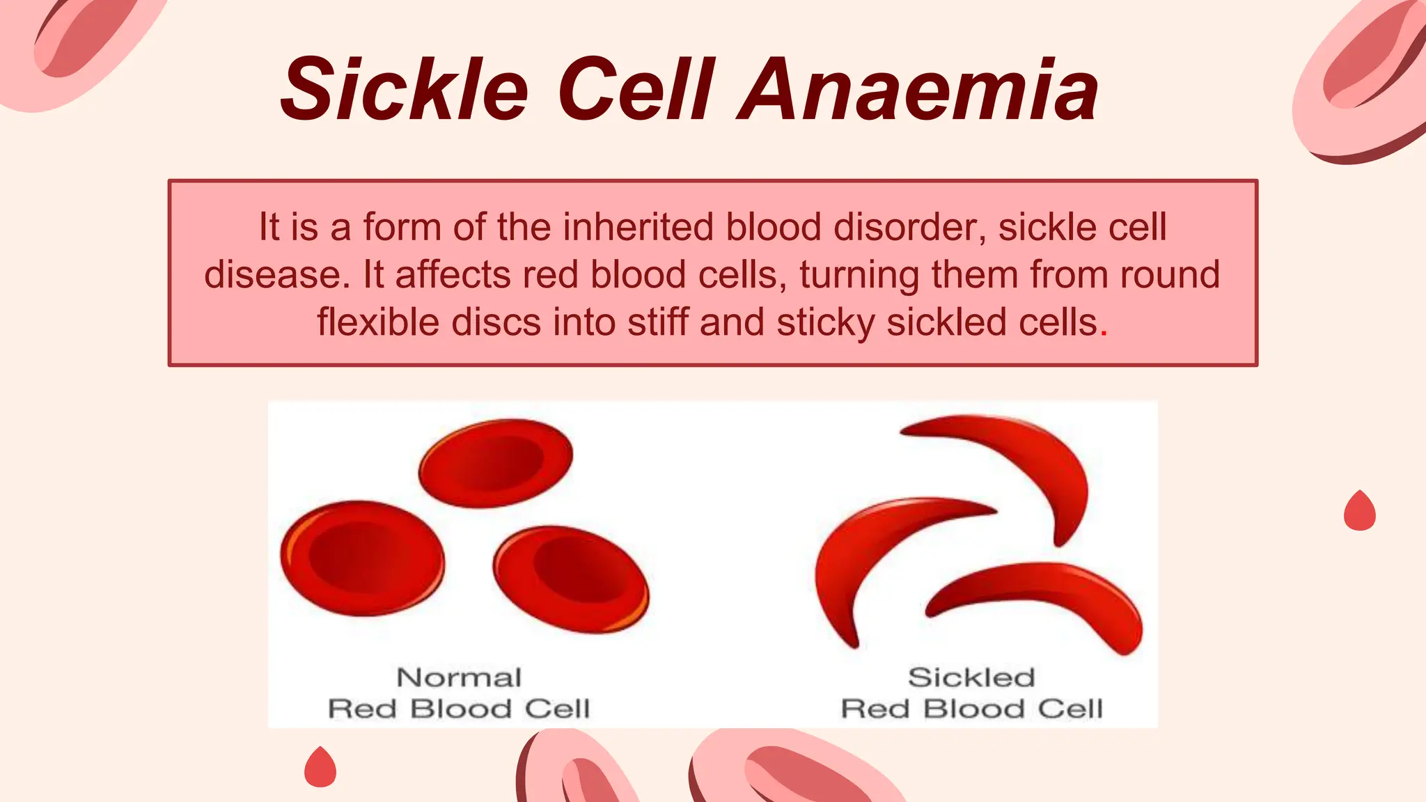 Sickle Cell Anemia. It gives basic idea and treatment of this disease | PPT