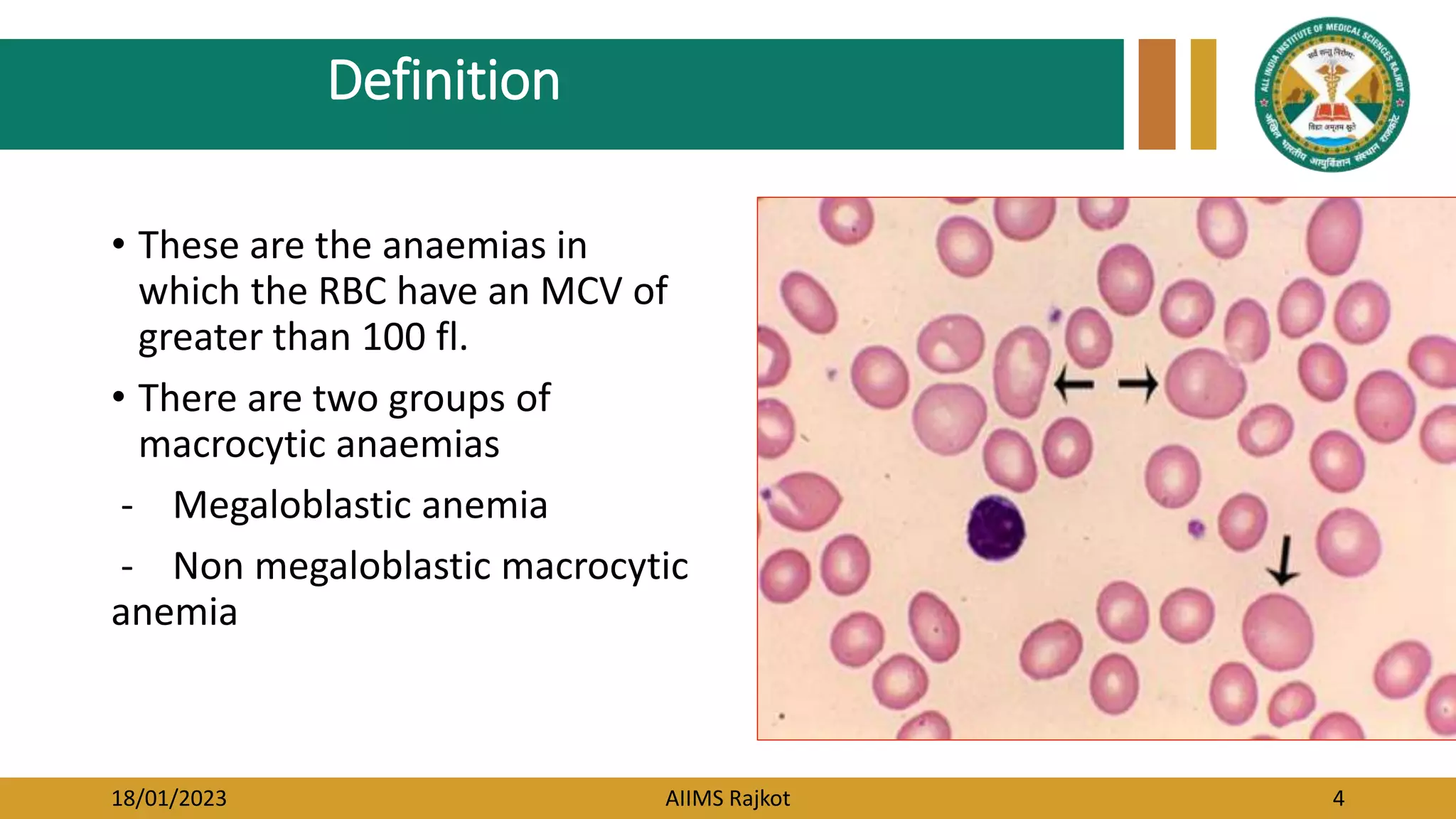 Macrocytic Anemia.pptx