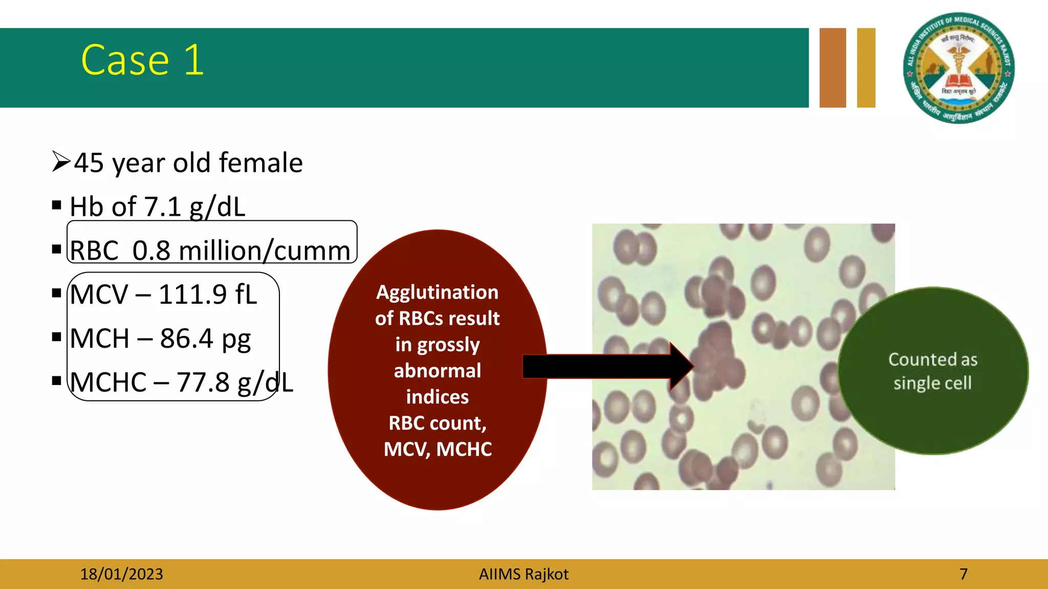 Macrocytic Anemia.pptx