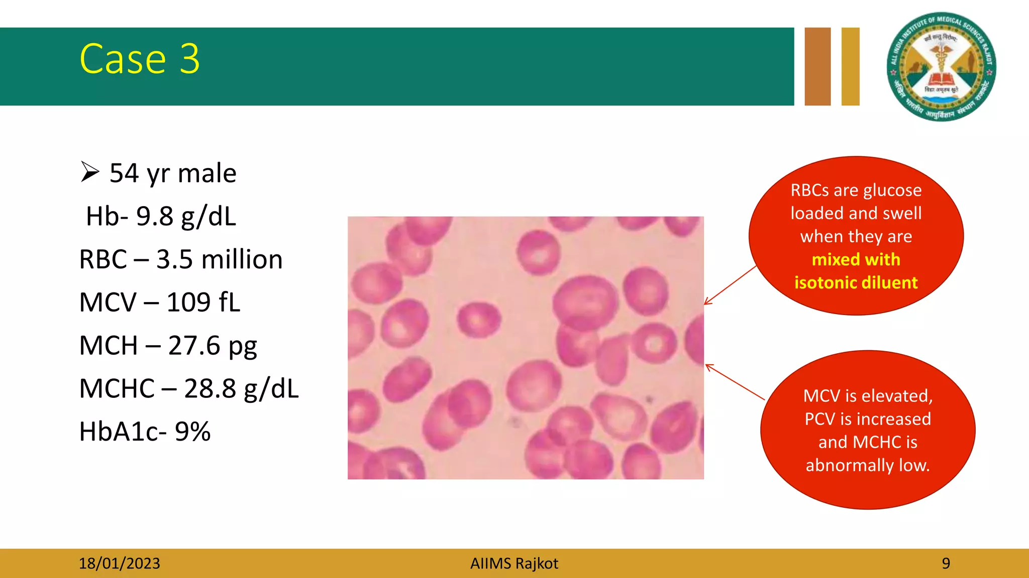 Macrocytic Anemia.pptx