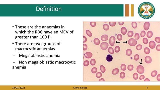 Macrocytic Anemia.pptx
