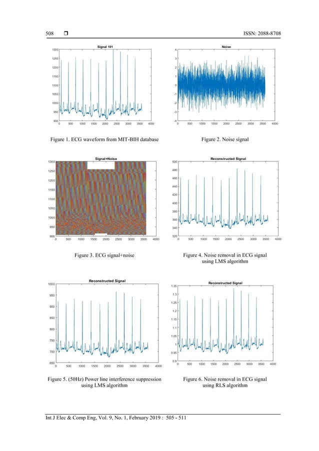 Noise reduction in ECG Signals for Bio-telemetryb | PDF | Digital Audio | Computer Software and ...