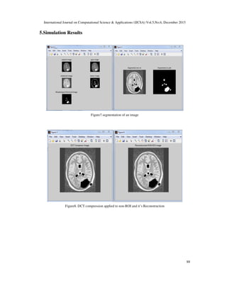 REGION OF INTEREST BASED COMPRESSION OF MEDICAL IMAGE USING DISCRETE WAVELET TRANSFORM | PDF