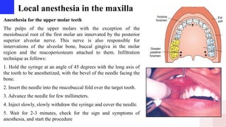 basic techniques of dental local anesthesia.pptx