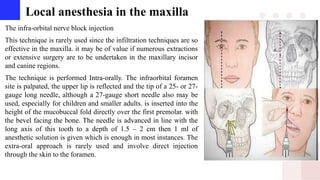 basic techniques of dental local anesthesia.pptx