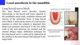 basic techniques of dental local anesthesia.pptx