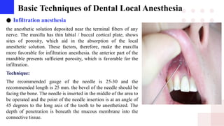 basic techniques of dental local anesthesia.pptx