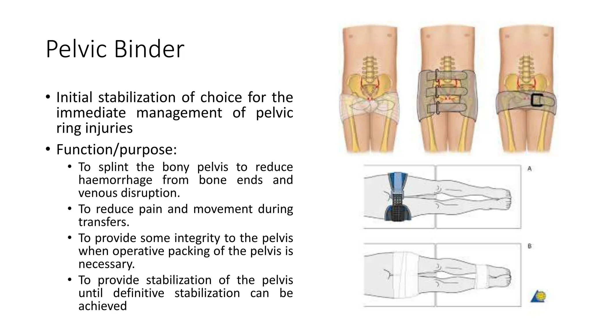 Immobilizationinpelvicinjury/fracture.pptx