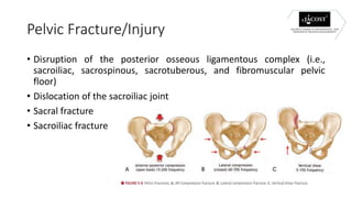 Immobilizationinpelvicinjury/fracture.pptx