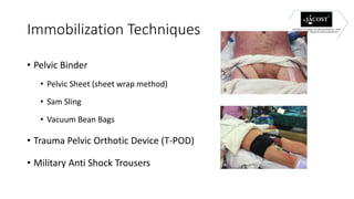 Immobilizationinpelvicinjury/fracture.pptx