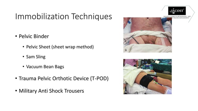 Immobilizationinpelvicinjury/fracture.pptx