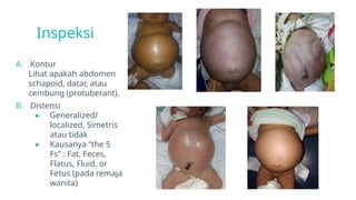 pemeriksaan fisik abdomen pada pediatrik | PPTX