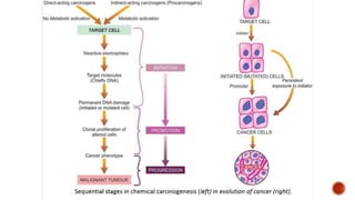 Carcinogenesis Stages