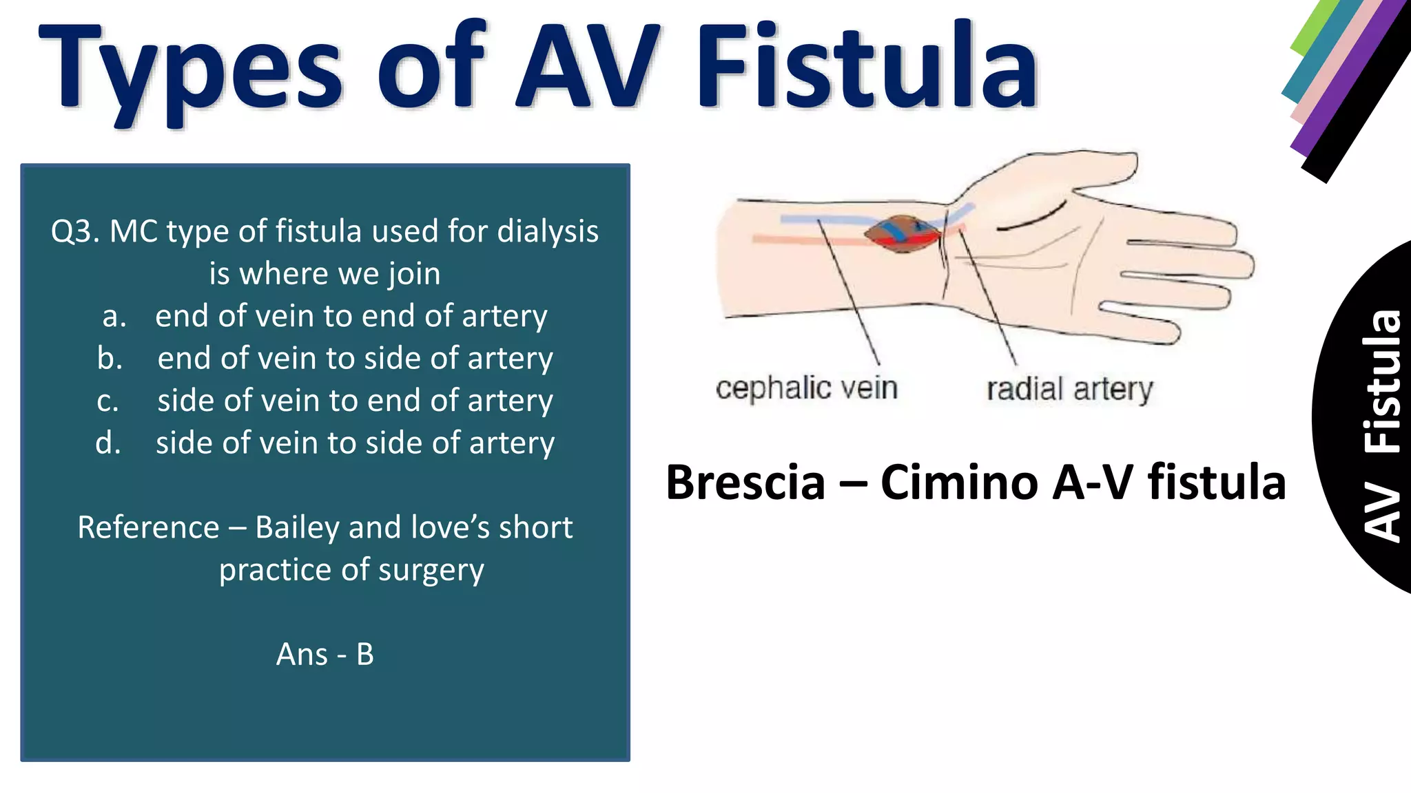 Role of USG in A-V fistula assessment | PPTX