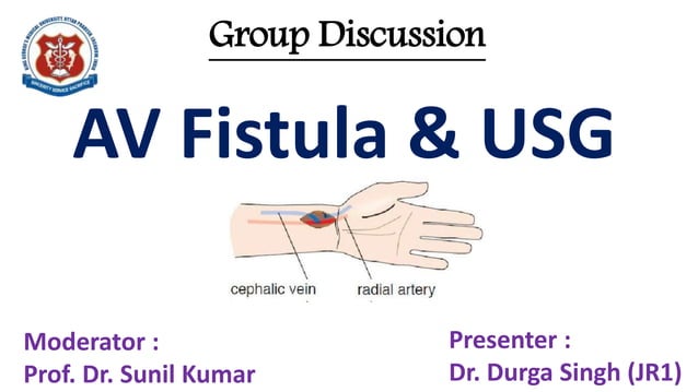 Role of USG in A-V fistula assessment | PPTX