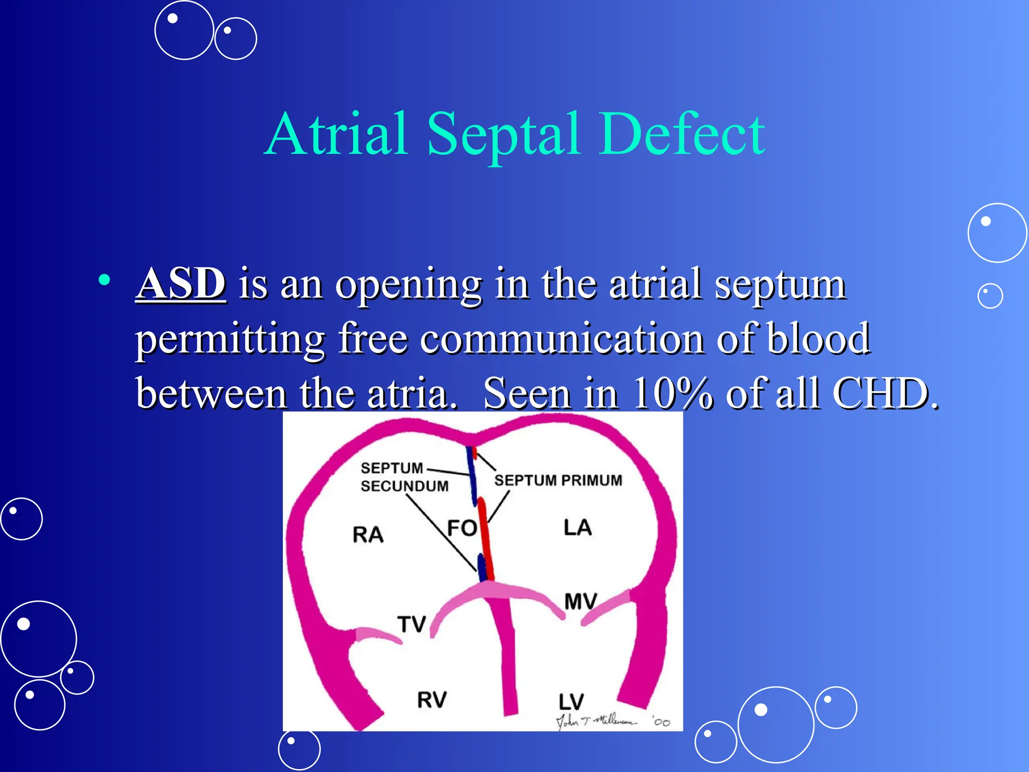 Congenital Heart Disease power point presentation | PPT