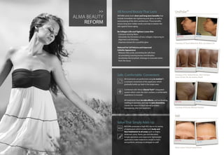 ALMA BEAUTY B2B Brochure WEB Spectrum | PDF